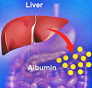 Elevated Albumin Levels - Causes, Symptoms, Treatment